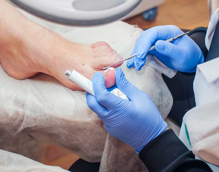 Podologue Béthune - Benjamin L'Intermy